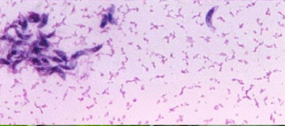 Researchers warn against parasites in raw vegetables, sea creatures ...